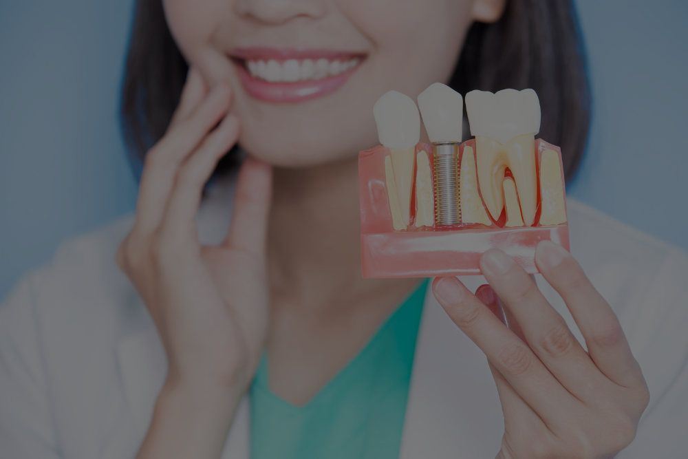 5 Signs You Might Need Dental Implants in Tijuana - Only Smile Experts